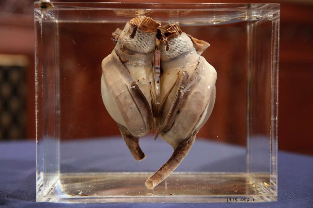 First Artificial Heart Transplant