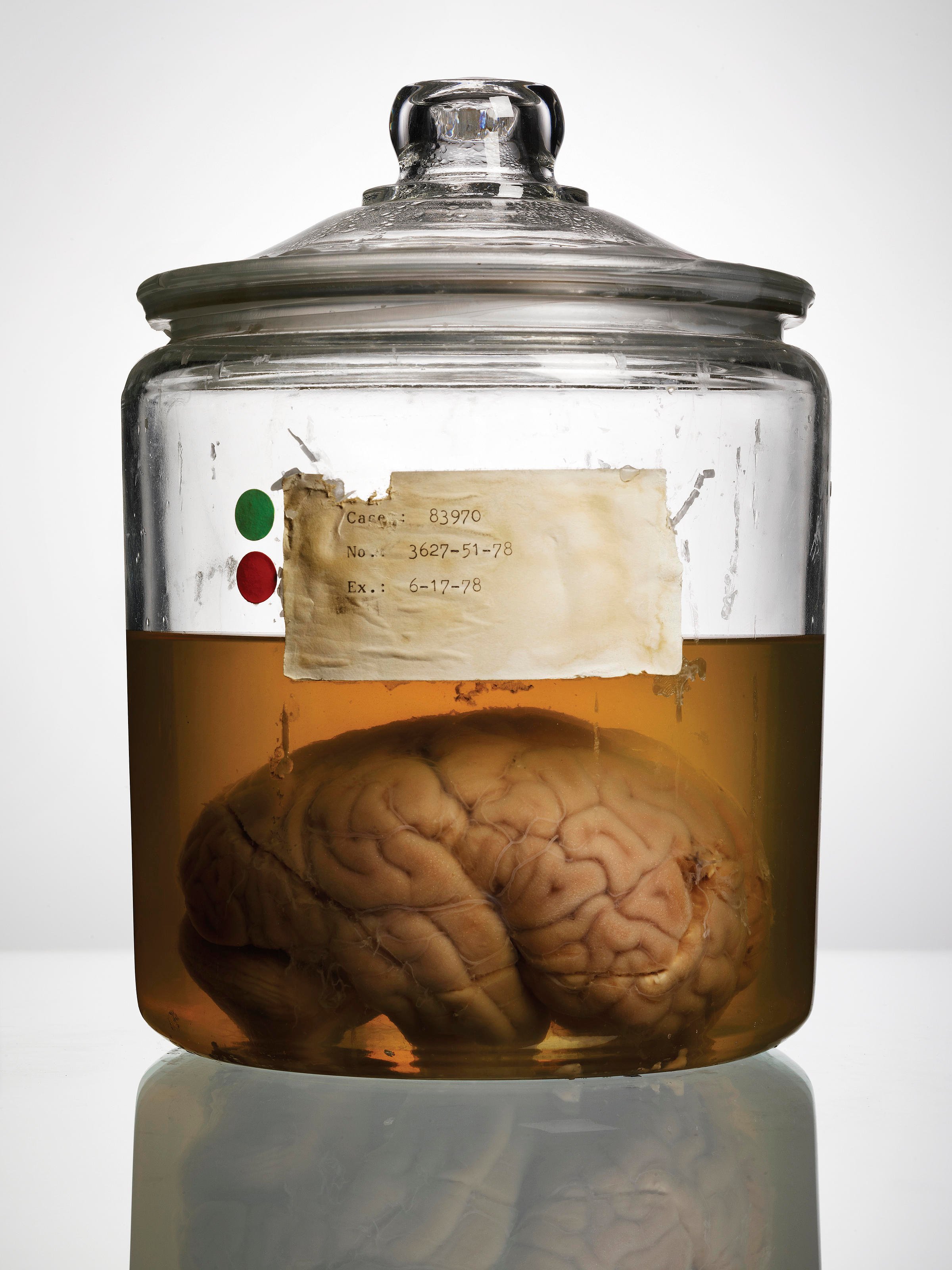 Real Human Brain In A Jar